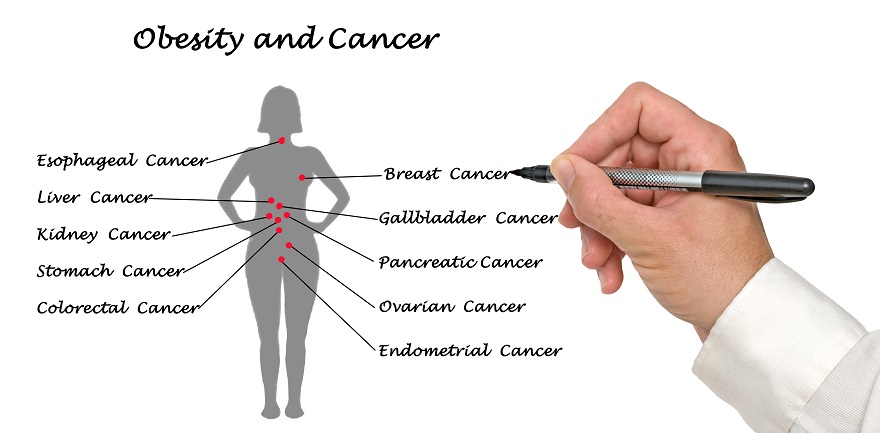The Connection between Obesity and Cancer